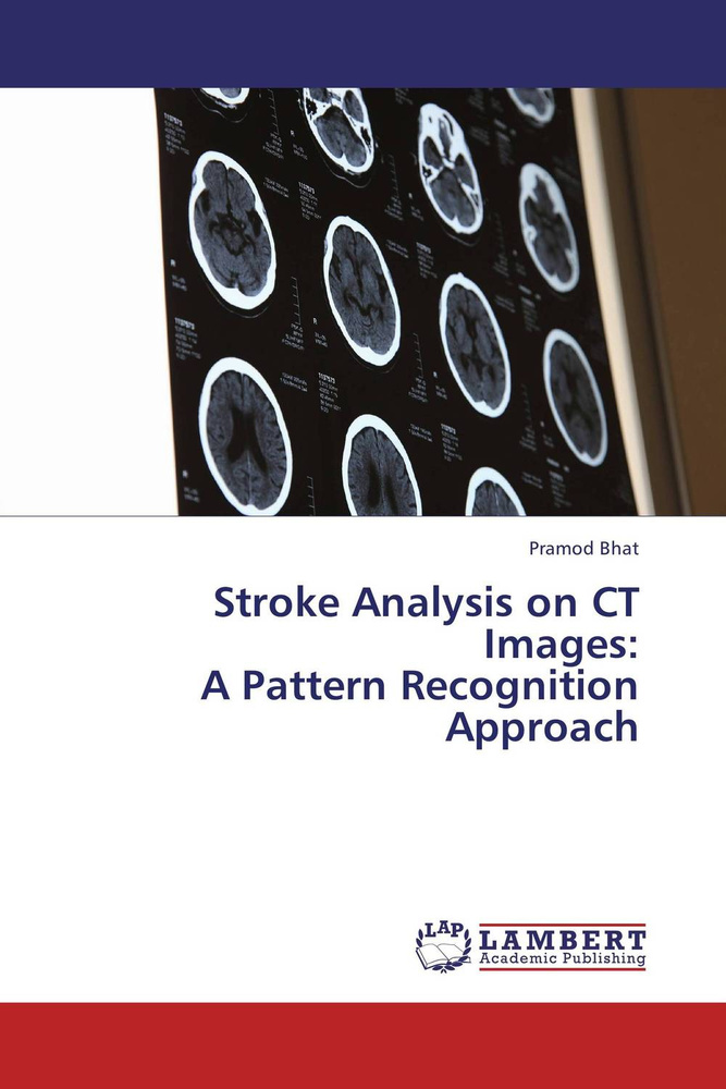 Stroke Analysis on CT Images: A Pattern Recognition Approach - купить с ...