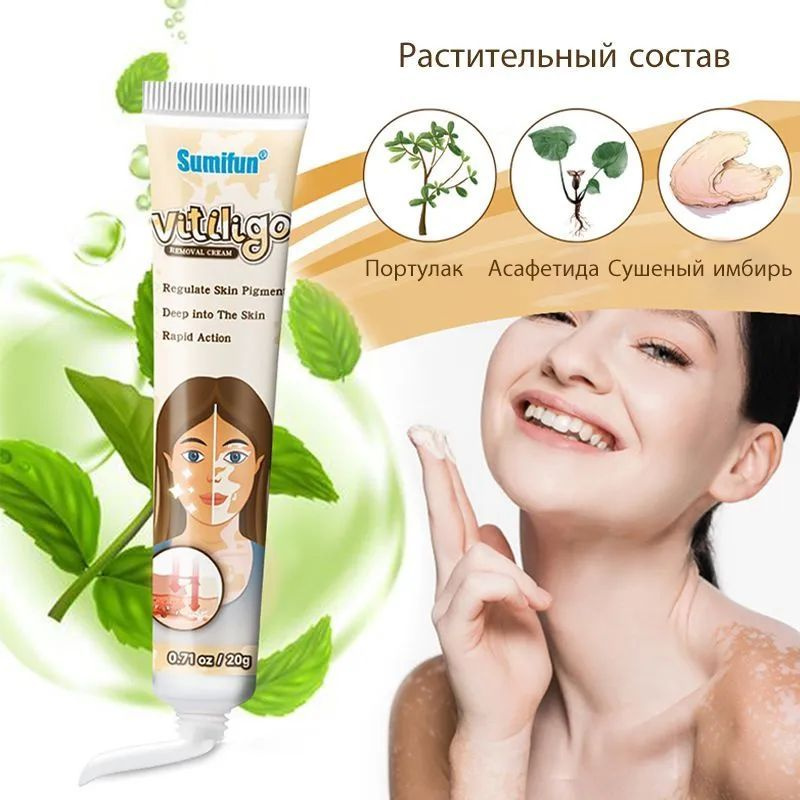Мазь для лечения белых пятен на теле Крем для усиления пигментации при витилиго лейкодерма