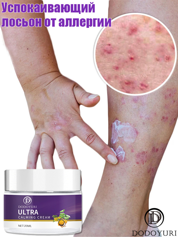 DODOYURI Антипсориаз / Крем мазь негормональный от псориаза, экземы ...
