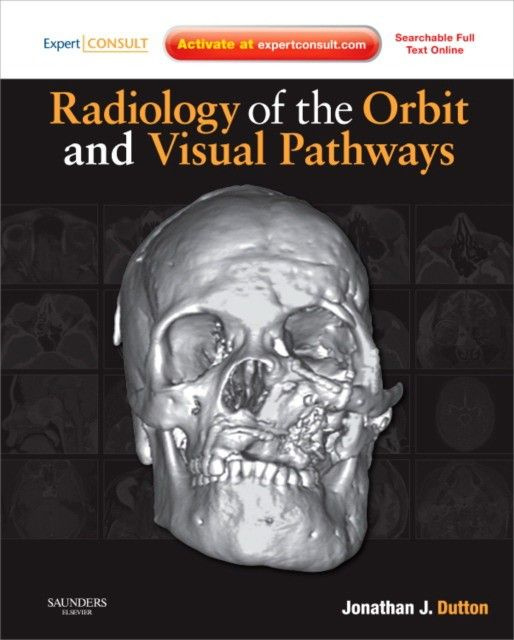 Radiology of the Orbit and Visual Pathways - купить с доставкой по ...