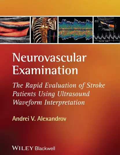 Neurovascular Examination. The Rapid Evaluation of Stroke Patients ...